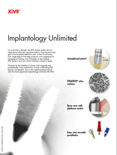 Dentsply Implants - XiVE® | FeedsFloor