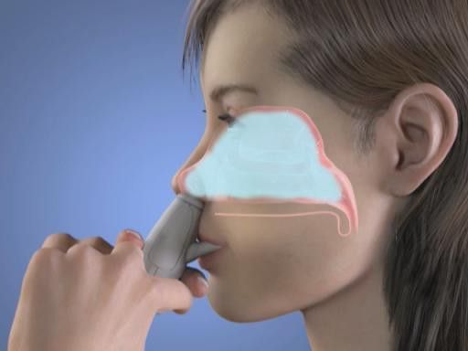 Advanced Nasal Packing Devices Transforming Nasal Surgery Outcomes ...